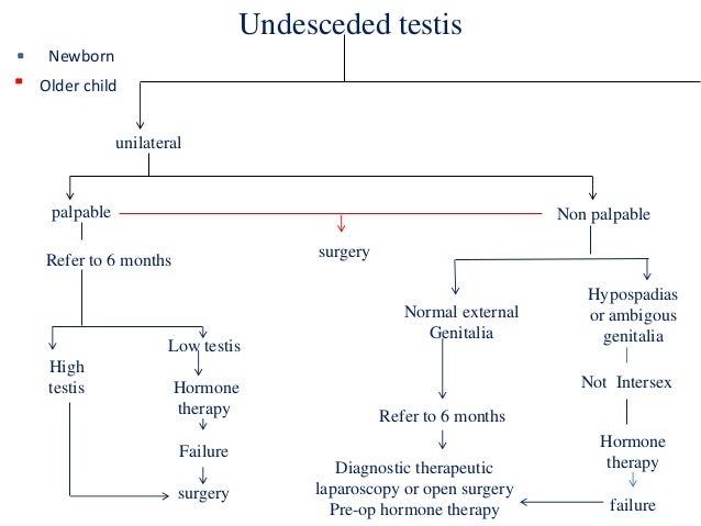 Recent trends in management of undescended testes