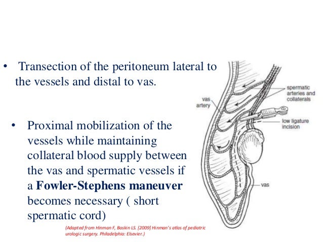 Recent trends in management of undescended testes