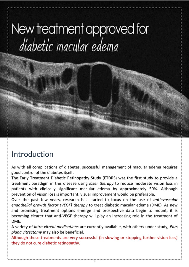 Recent Treatment of DME | PDF
