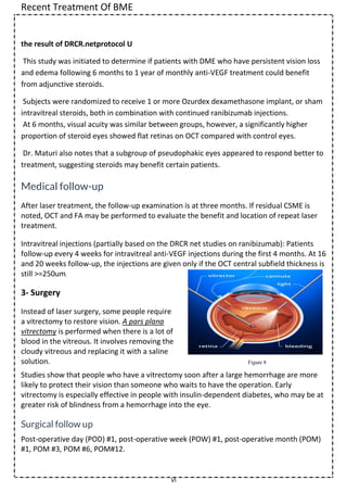 Recent Treatment of DME | PDF