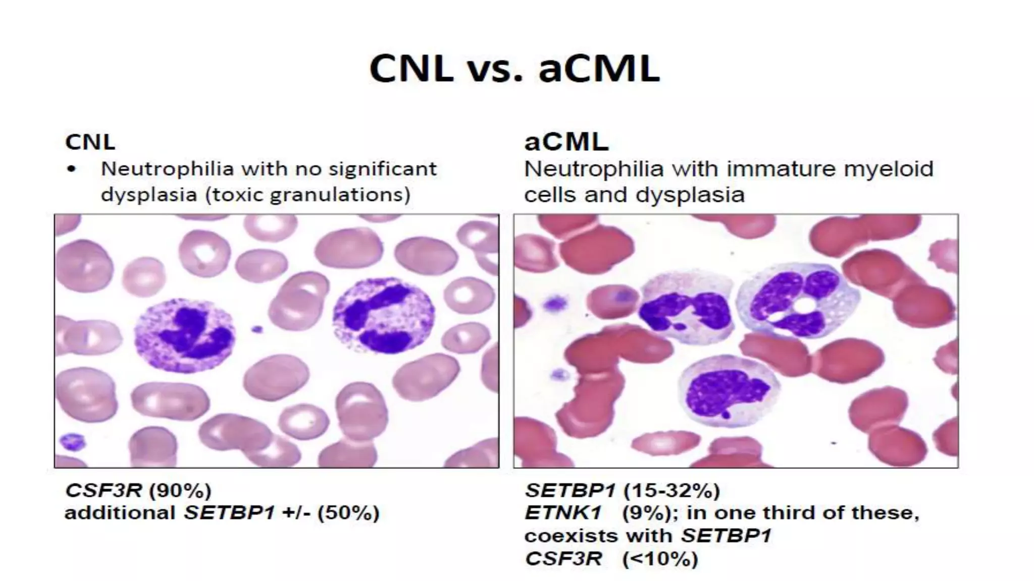 Recent updates in classification of mds and myeloid neoplasm | PPT