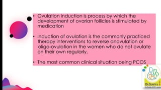Recent updates in ovulation induction in pcos | PDF