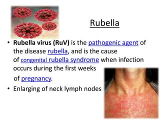 viruses and viral diseases | PPTX