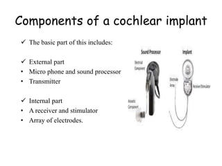 The Nucleus Hybrid L24 Cochlear Implant System for sensorineural ...