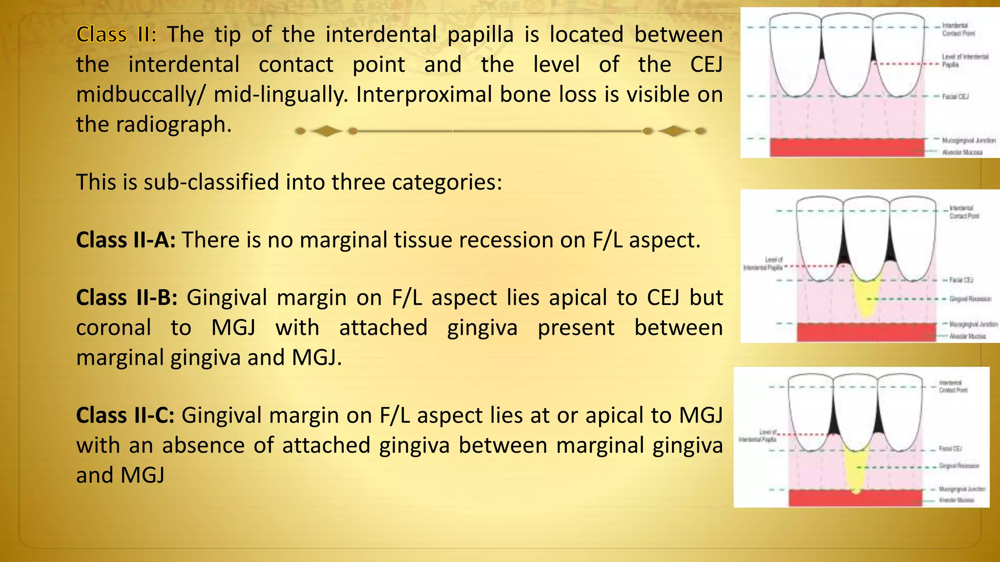 Gingival Recession | PPTX