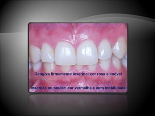 Cirurgia Plástica Periodontal | PPT