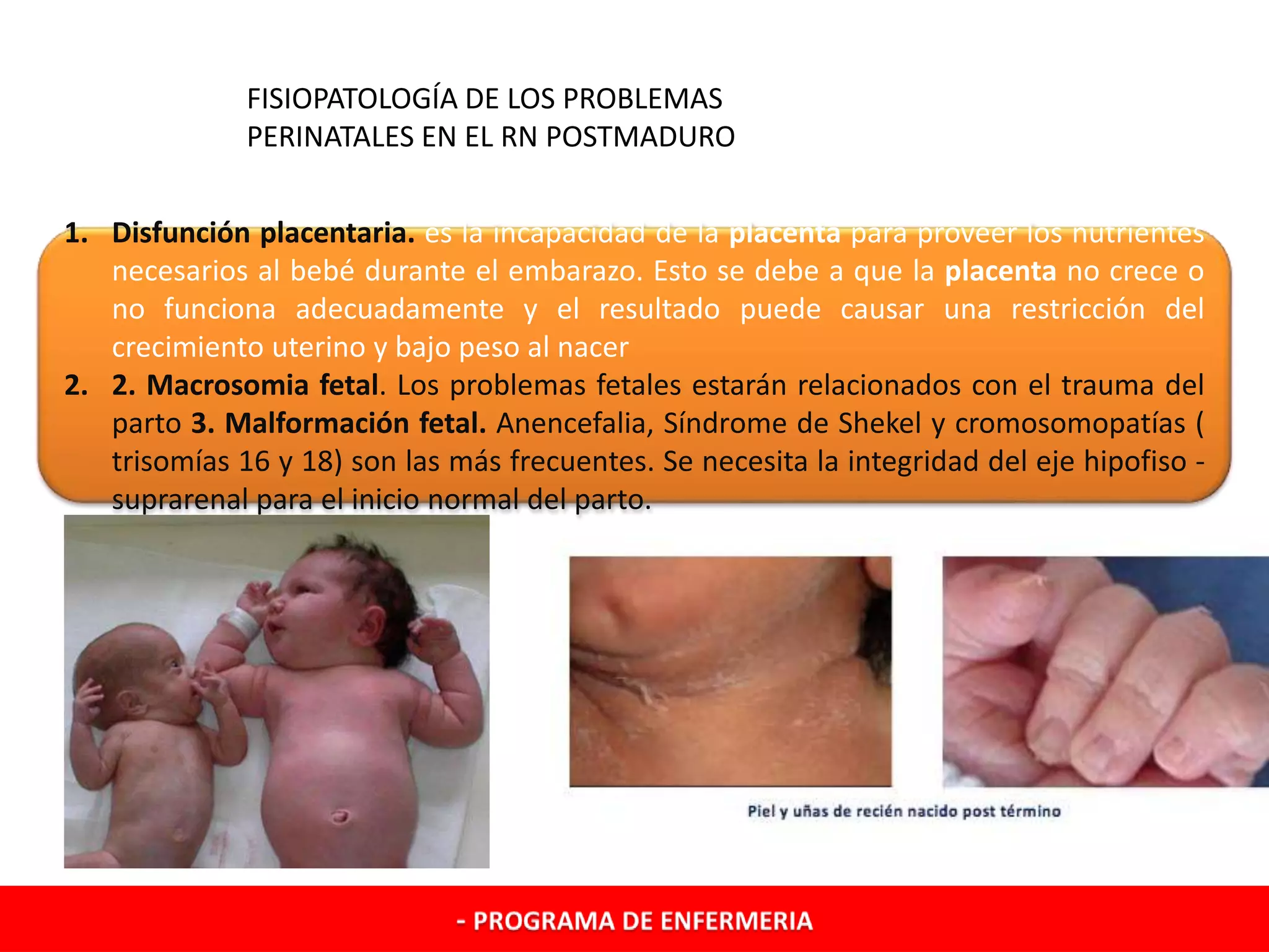 Recien Nacido Pretermino A Termino Y Postermino Pptx