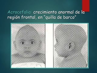 RECIEN NACIDO postgradoyusbeli.ppt
