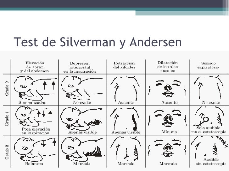 Recién nacido normal