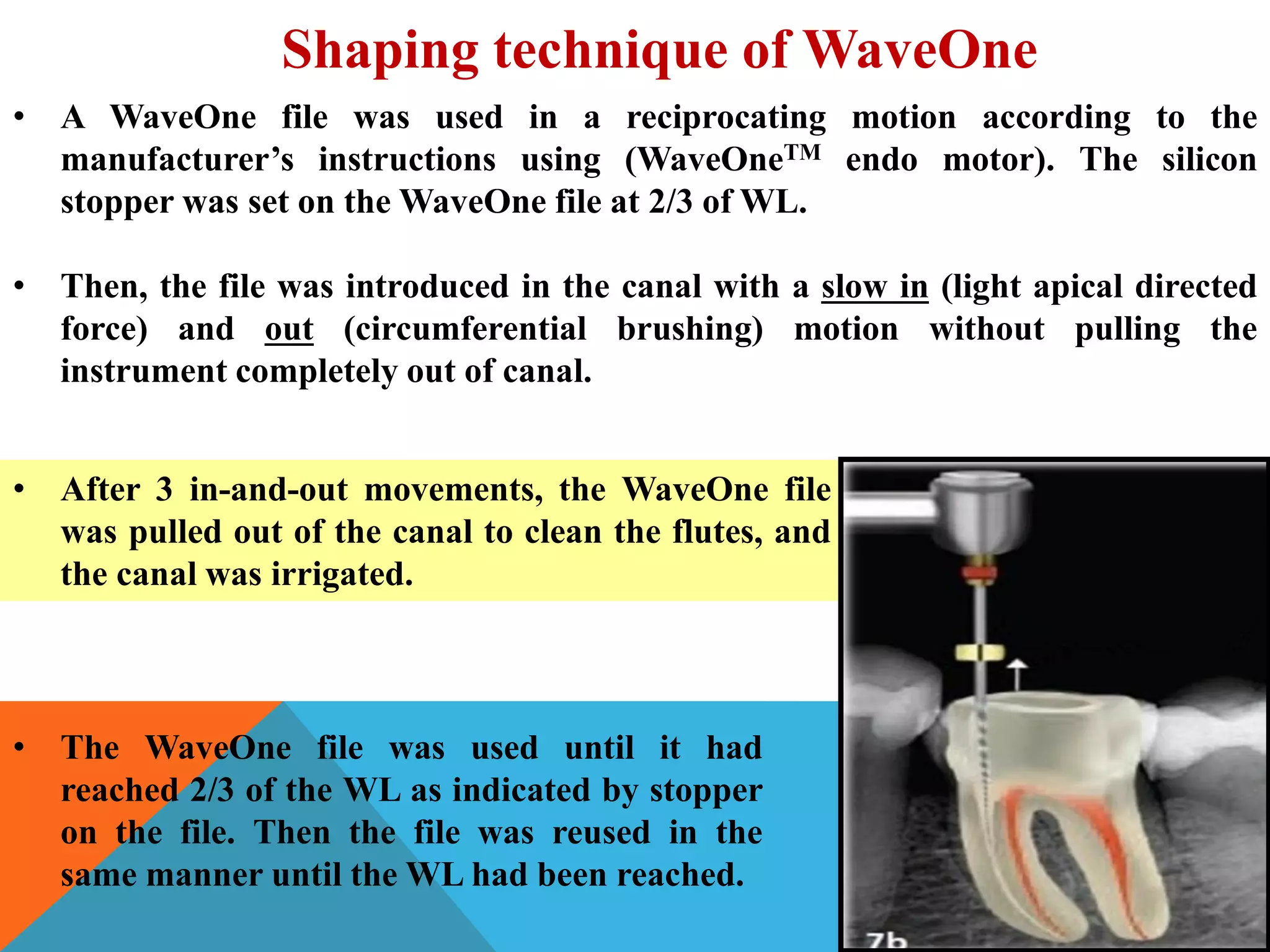 Reciprocating instruments in endodontics | PDF