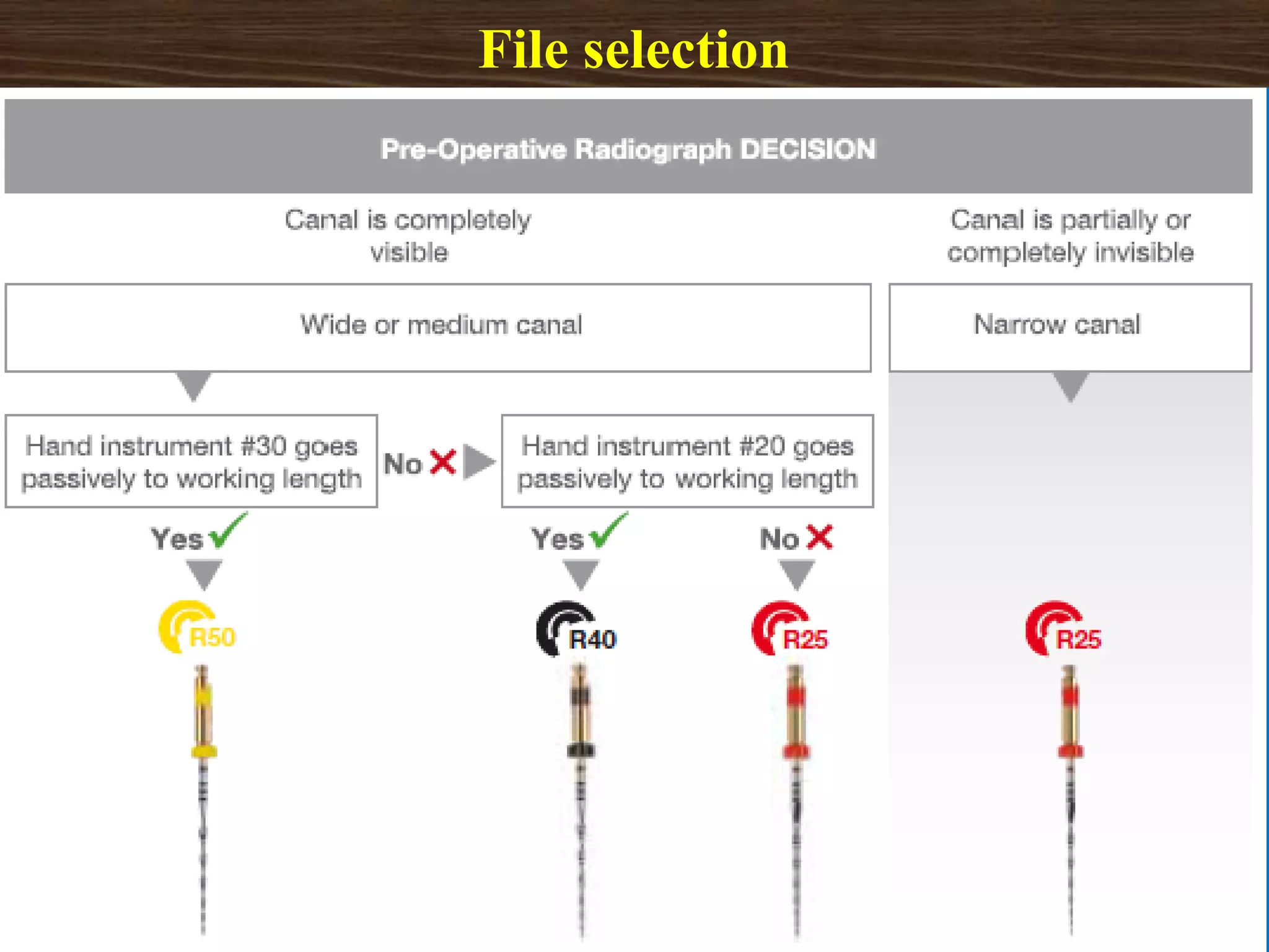 Reciprocating instruments in endodontics | PDF