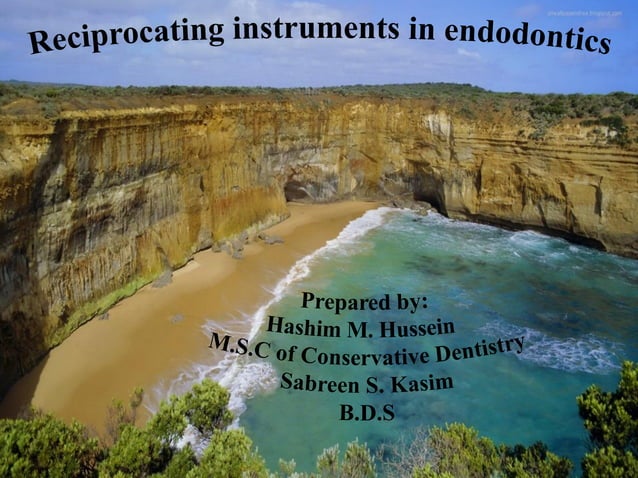 Reciprocating instruments in endodontics | PDF