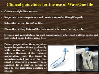 Reciprocating instruments in endodontics | PDF