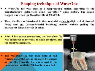 Reciprocating instruments in endodontics | PDF
