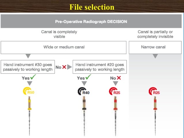 Reciprocating instruments in endodontics | PDF