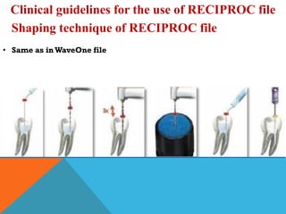 Reciprocating instruments in endodontics | PDF