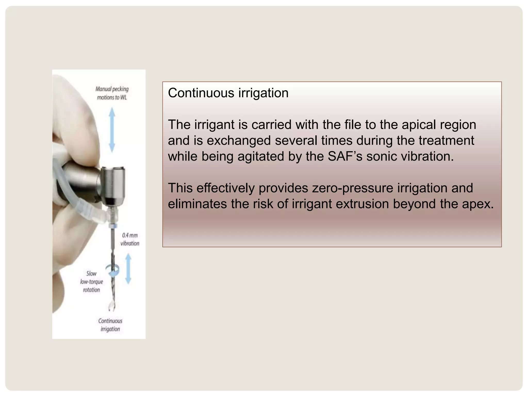 Reciprocation in Endodontics | PPTX