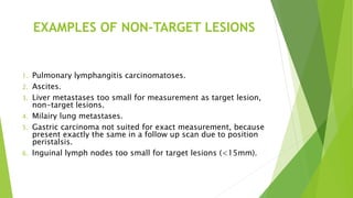 recist criteria Response Evaluation Criteria In Solid Tumors.pptx