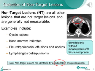 RECIST irRECIST Imaging Criteria Training.pdf