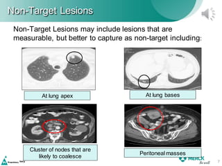 RECIST irRECIST Imaging Criteria Training.pdf