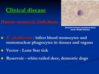 Reckettsia dr.ihsan alsaimary | PPT