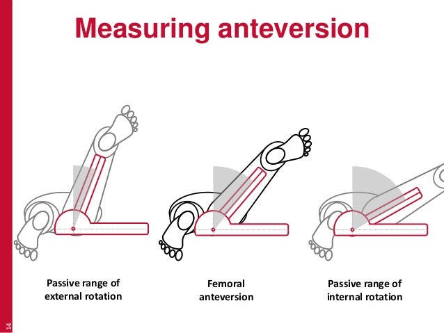 Recognising features (bone and joint deformity)