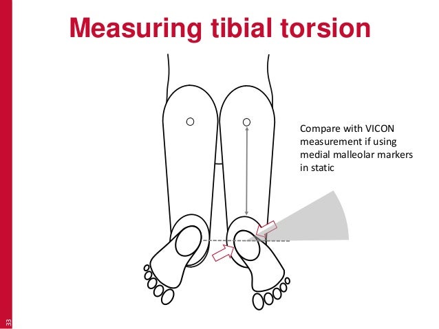 Recognising features (bone and joint deformity)