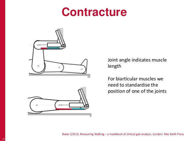 Recognising features (contracture and spasticity)