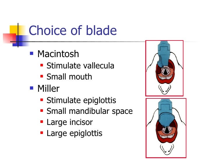Recognition And Management Of Difficult Airway