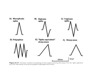 Recognition of abnormal EEG. | PPTX