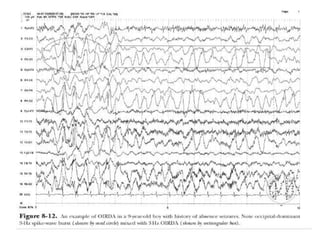 Recognition of abnormal EEG. | PPTX