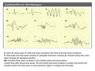 Recognition of abnormal EEG. | PPTX