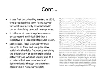 Recognition of abnormal EEG. | PPTX