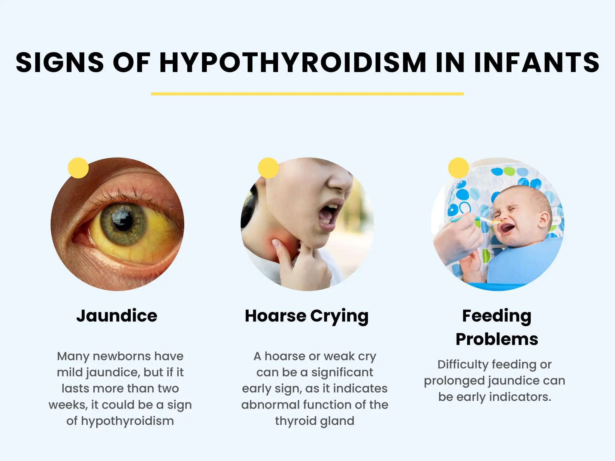 Recognizing Hypothyroidism in Youngsters Key Signs in Infants and ...