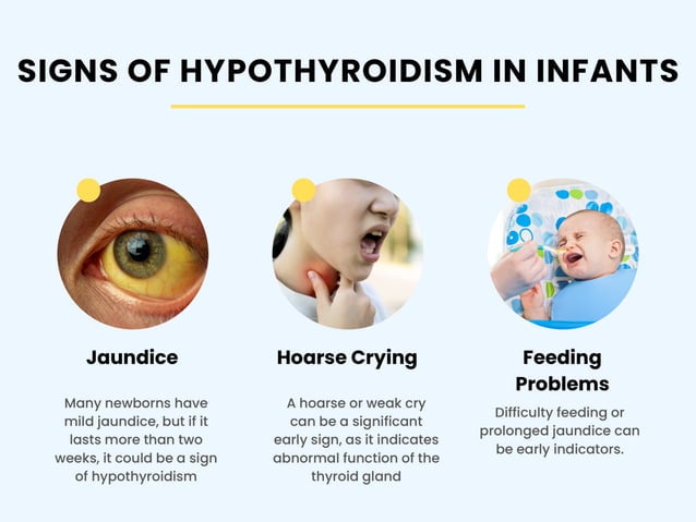 Recognizing Hypothyroidism in Youngsters Key Signs in Infants and ...