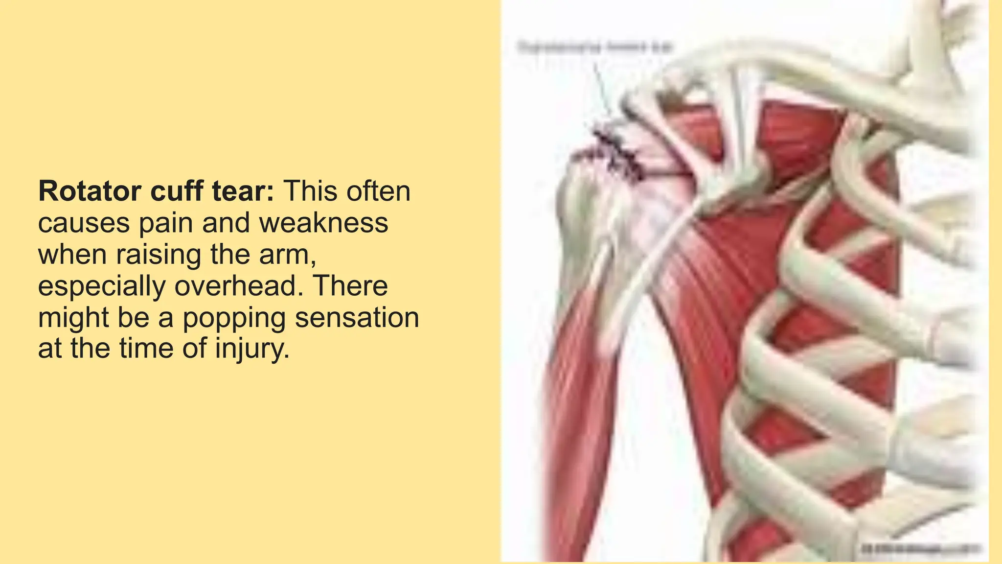 Recognizing sport injuries of upper and lower extremities.pptx