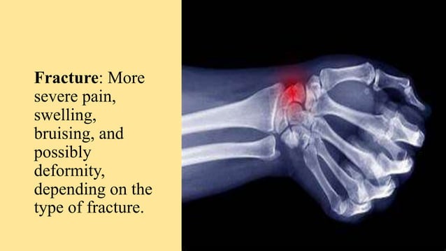 Recognizing sport injuries of upper and lower extremities.pptx