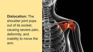 Recognizing sport injuries of upper and lower extremities.pptx