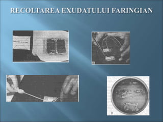 RECOLTAREA EXUDATULUI FARINGIAN, SPUTEI, SECRETIILOR PURULENTE ȘI ...