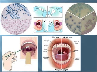 RECOLTAREA EXUDATULUI FARINGIAN, SPUTEI, SECRETIILOR PURULENTE ȘI ...
