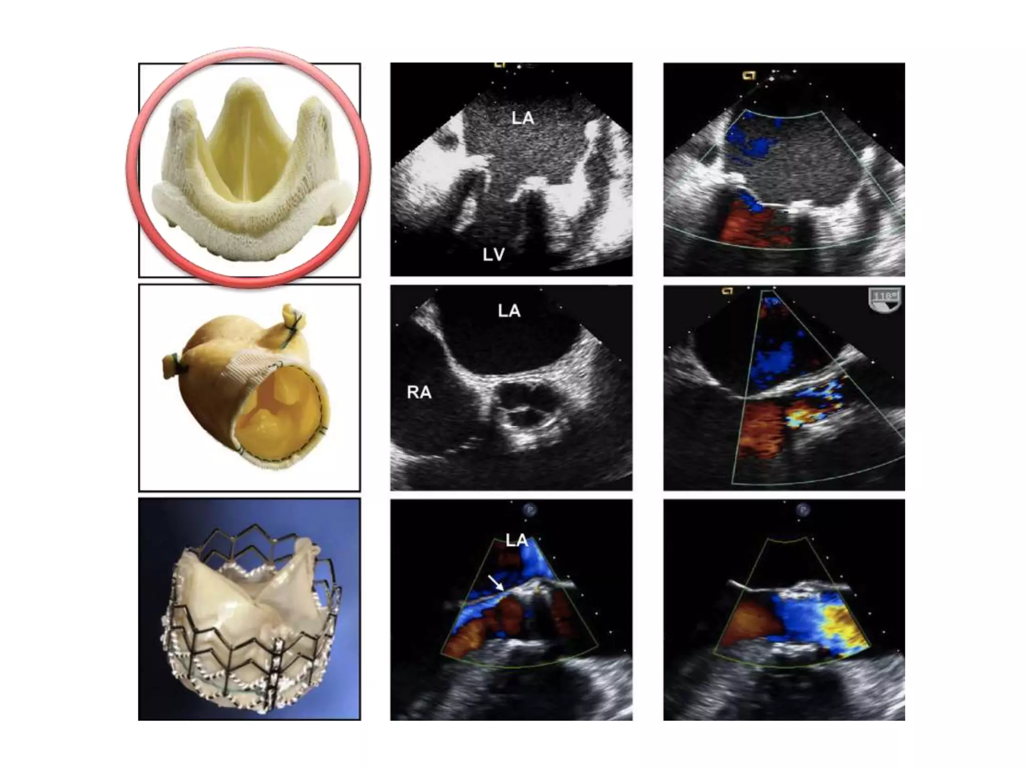 Recommendations for Evaluation of Prosthetic Valves With ...