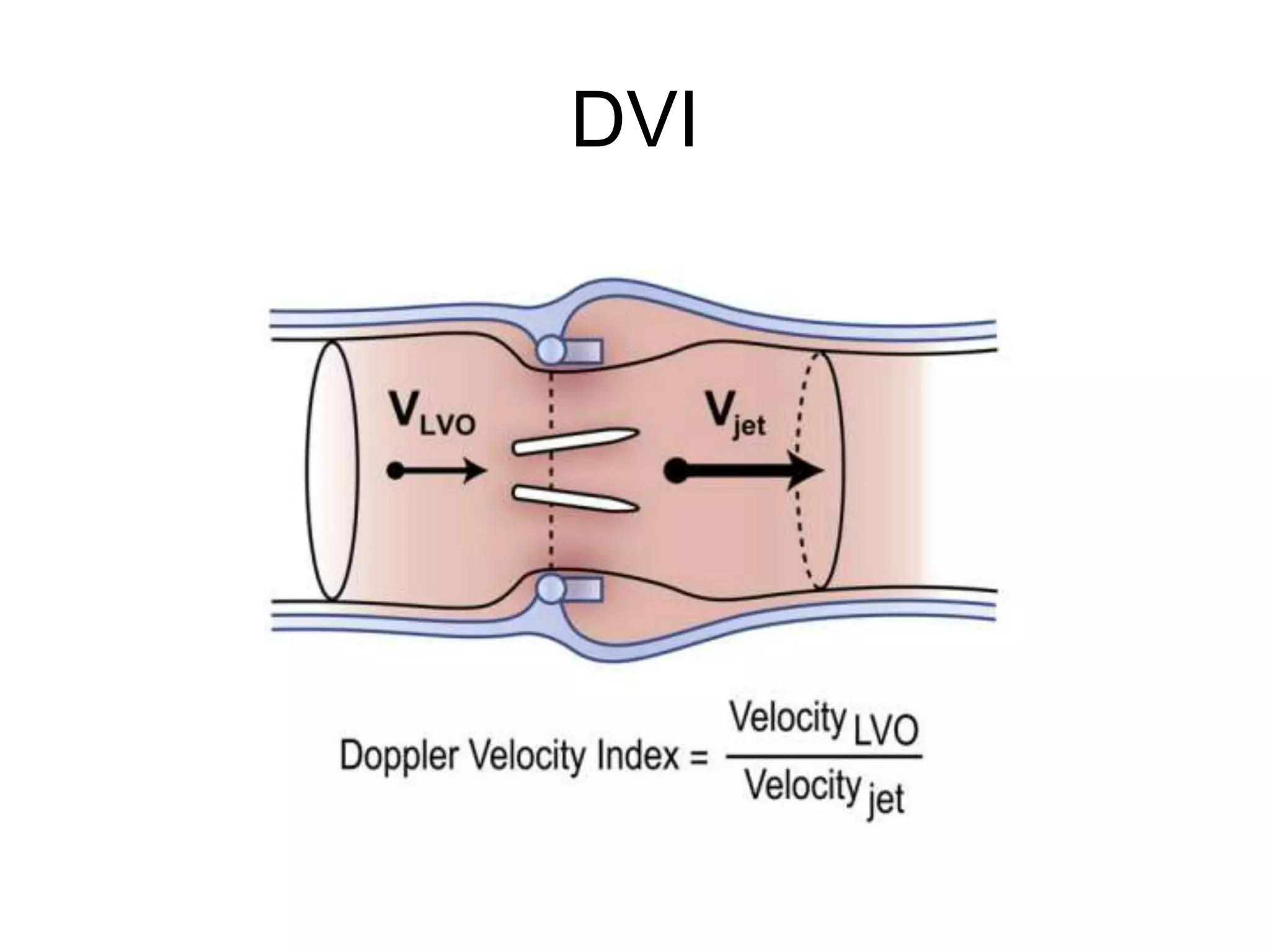 Recommendations for Evaluation of Prosthetic Valves With ...