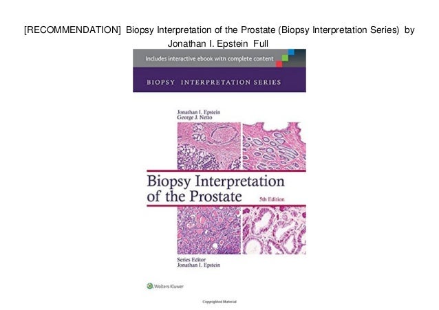 Prostate Biopsy Interpretation: An Illustrated Guide – MUCMV