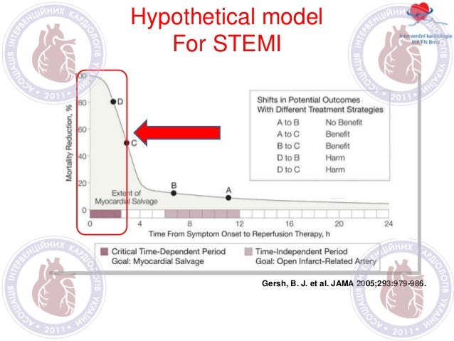 Recommendation for stemi treatment in 2013 and stent for life initiat…