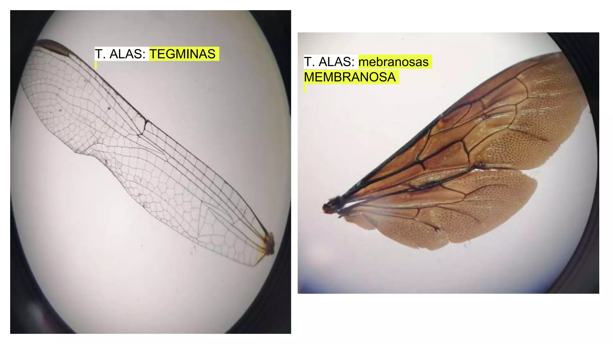 ENTOMOLOGIA: Partes de insectos | PPTX | Eye and Vision Conditions ...