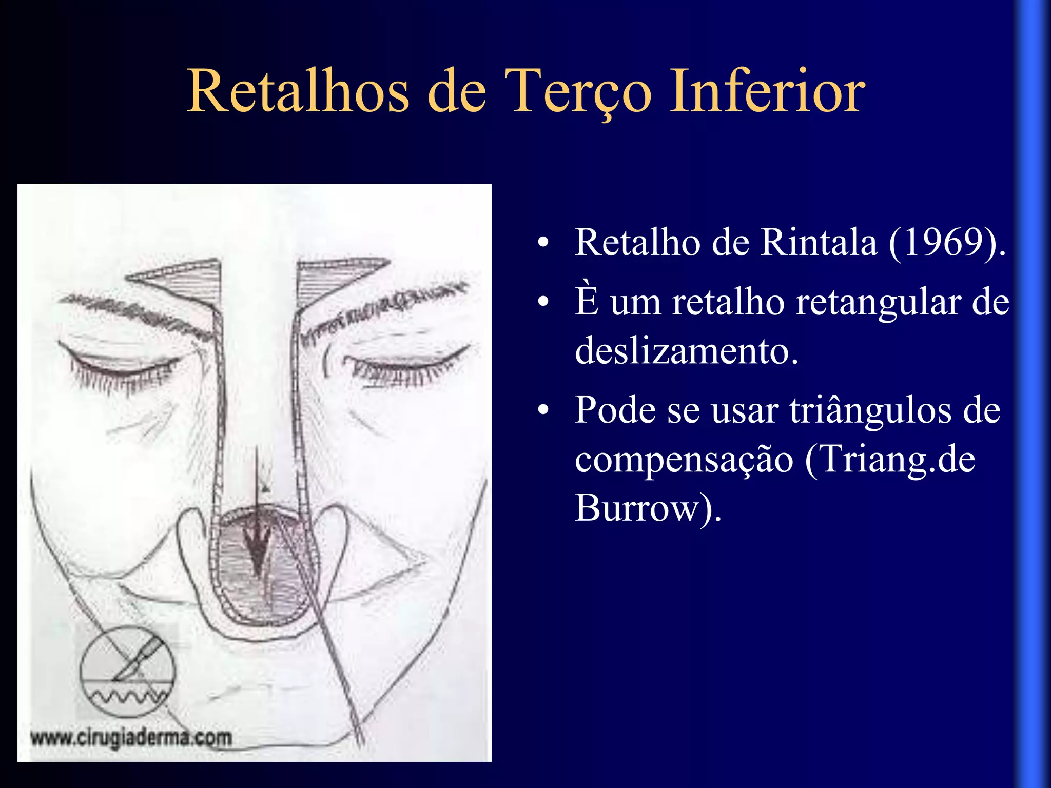 Reconstrução Nasal
