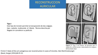 Reconstruccion auricular | PPTX