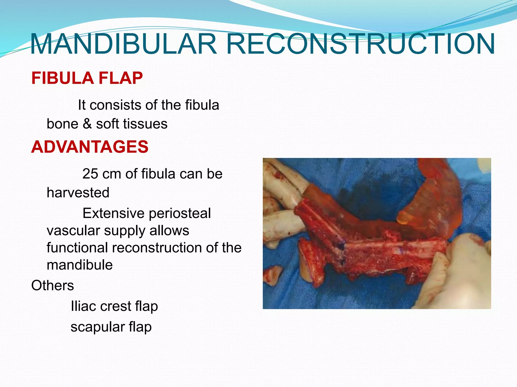 Reconstruction in head and neck surgeries | PPTX
