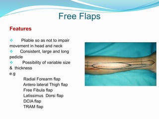 Reconstruction in head and neck surgeries | PPTX