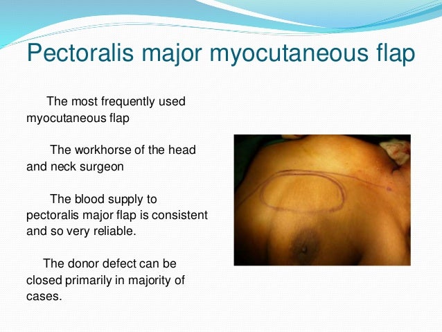 Reconstruction in head and neck surgeries